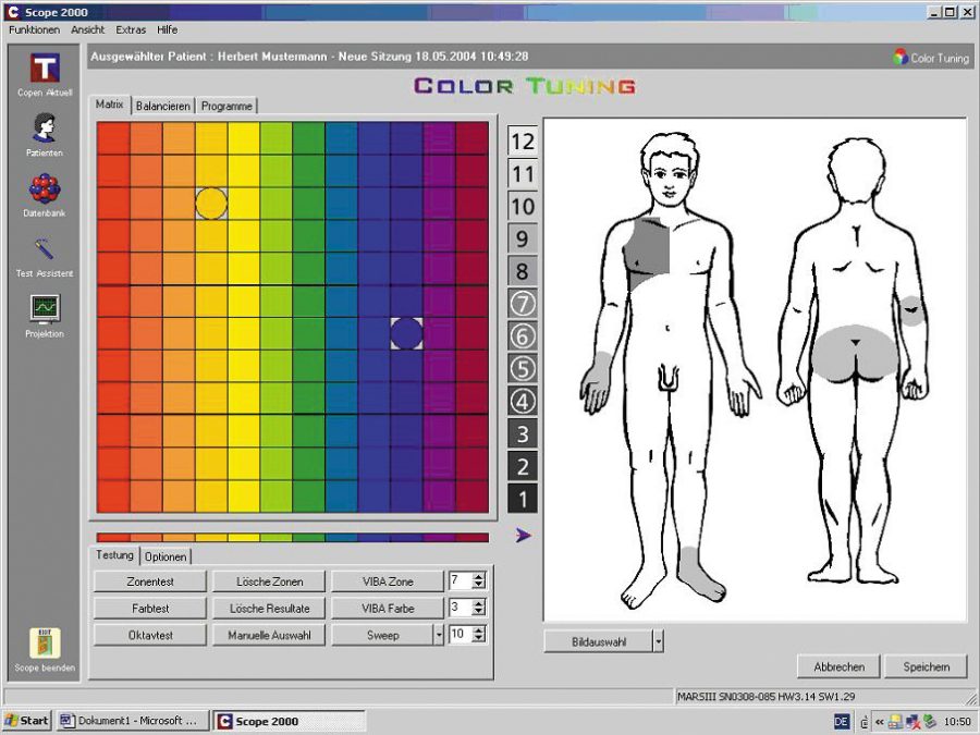 Copen Scope / Mars III – Bruce Copen Laboratories